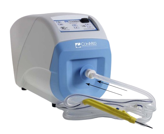 Conmed 60-7520-005 - Smoke Pencil with Rocker Switch, UltraClean Blade ...