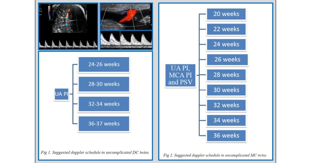 Routine doppler ultrasound in Twin Pregnancy
