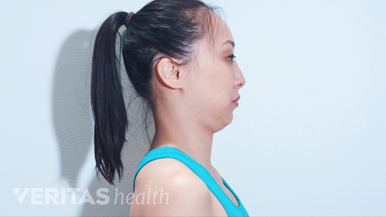 Lifestyle Changes to Treat Chronic Stiff Neck | Spine-health