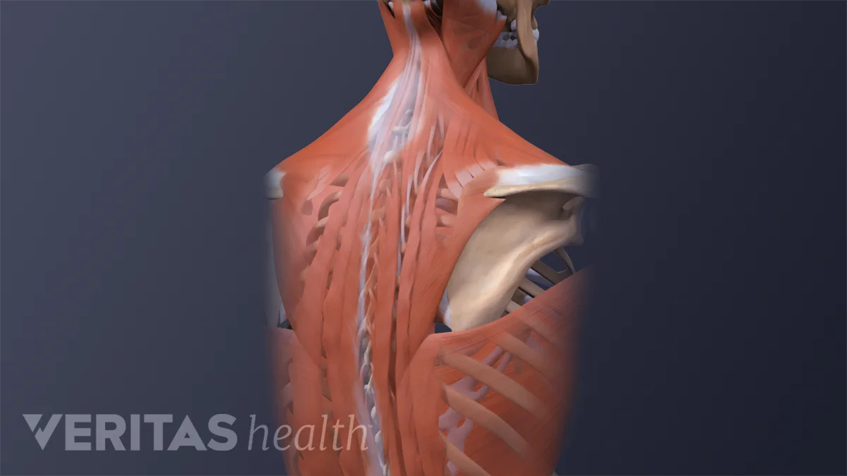 What Causes Upper Left Back Pain? | Spine-health