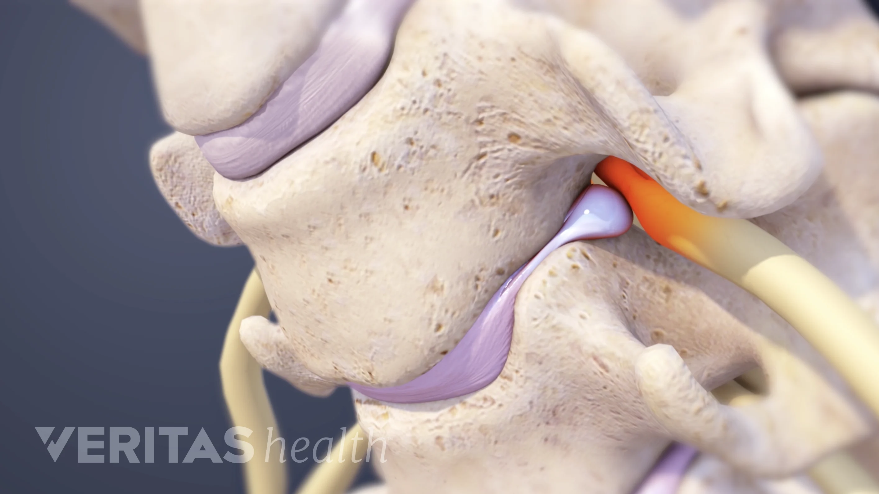 Video: The Difference Between Disc Terms | Spine-health