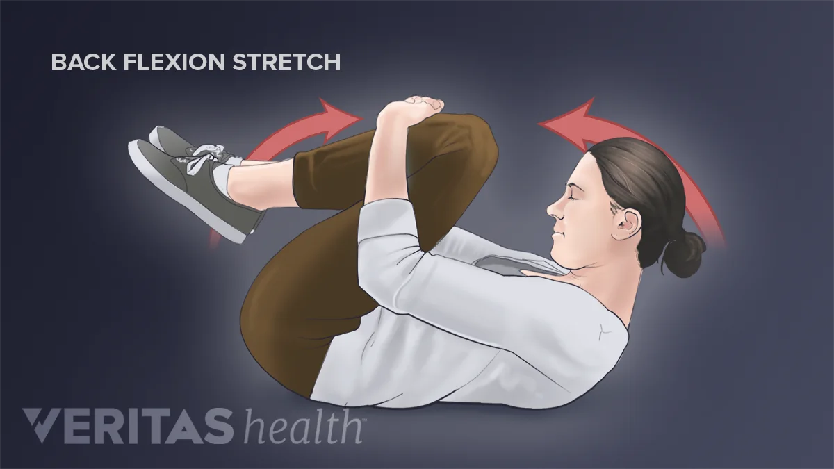 Exercise for Sciatica from Spinal Stenosis | Spine-health
