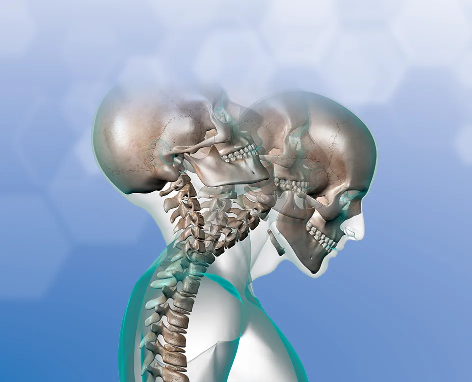 3 Reasons You May Have a Stiff Neck | Spine-health