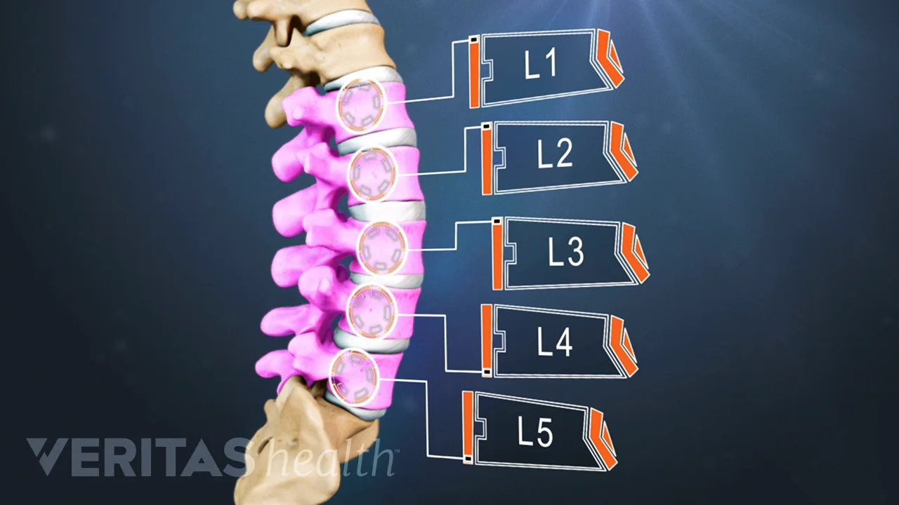 Causes of Pain in the Lumbar Spine | Spine-health