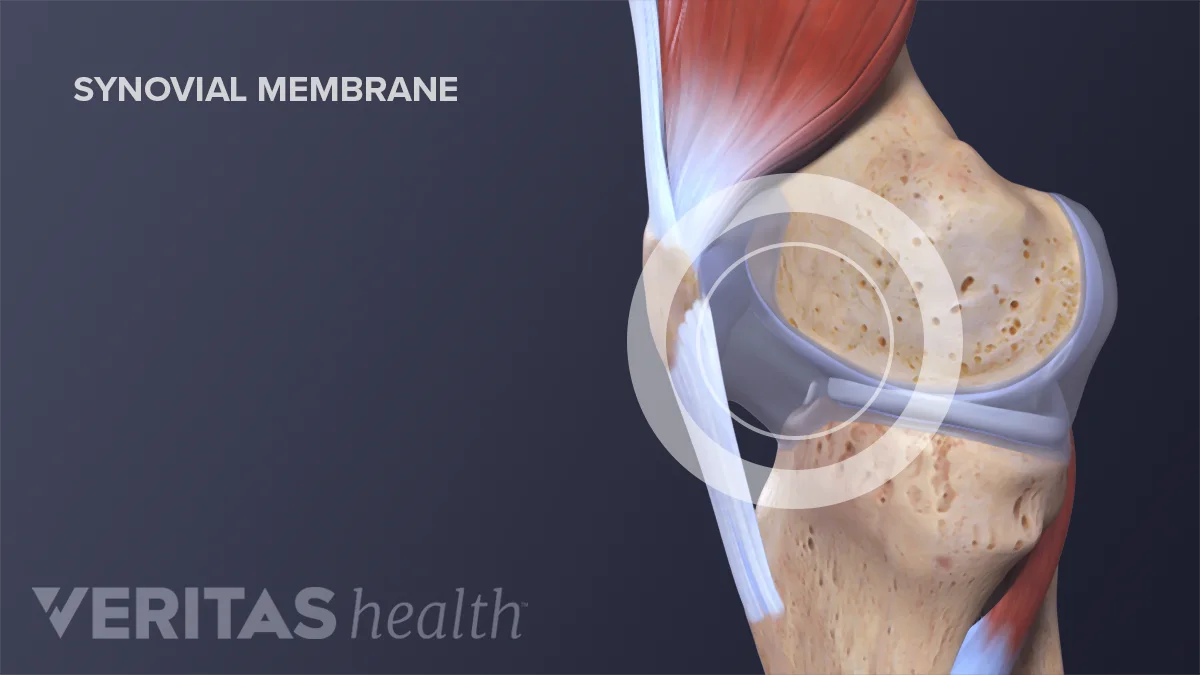 What Is a Synovial Joint? | Arthritis-health