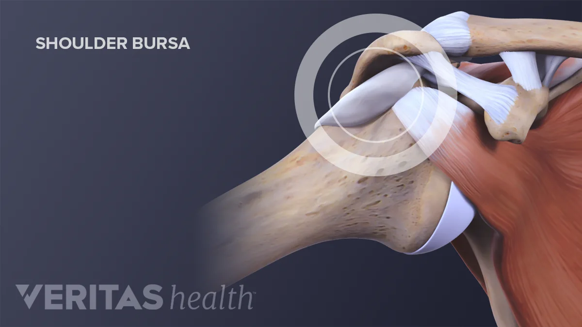 Shoulder Bursitis Diagnosis | Arthritis-health