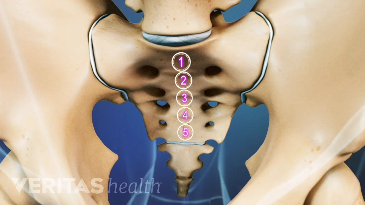 What to Know About Sacroiliac Joint Fusion | Spine-health