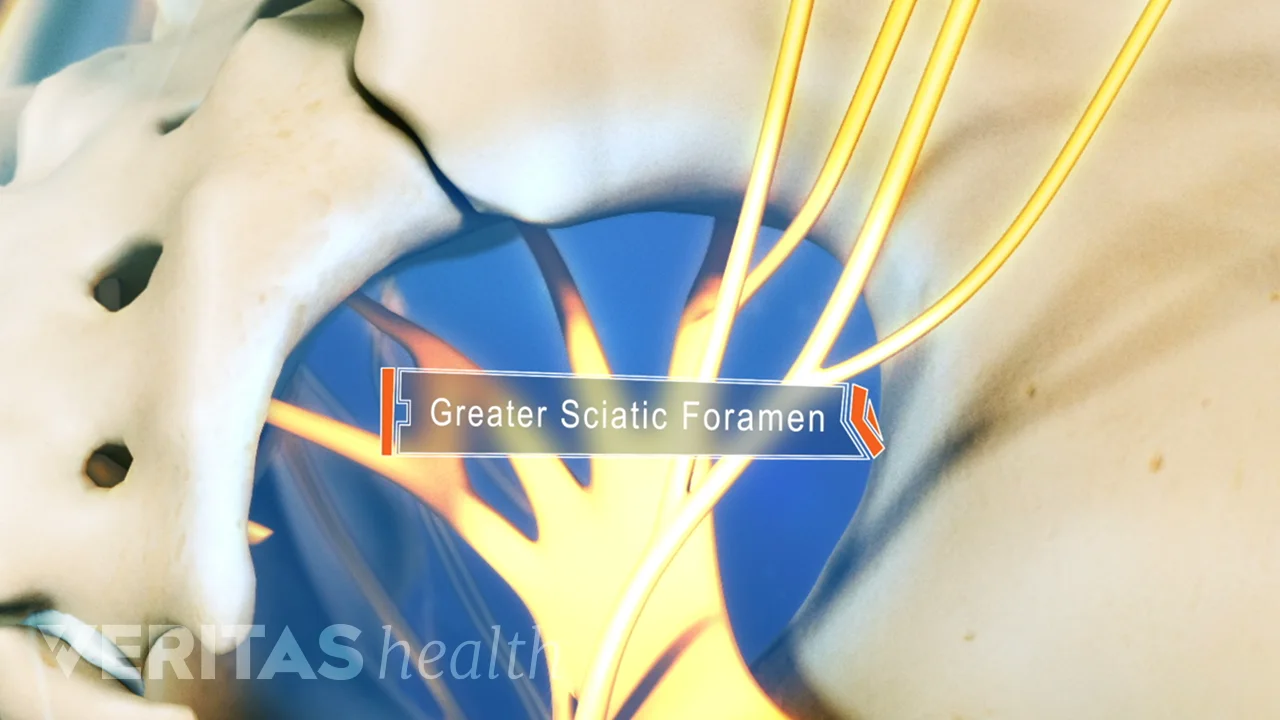 Sciatic Nerve Anatomy Video | Spine-health