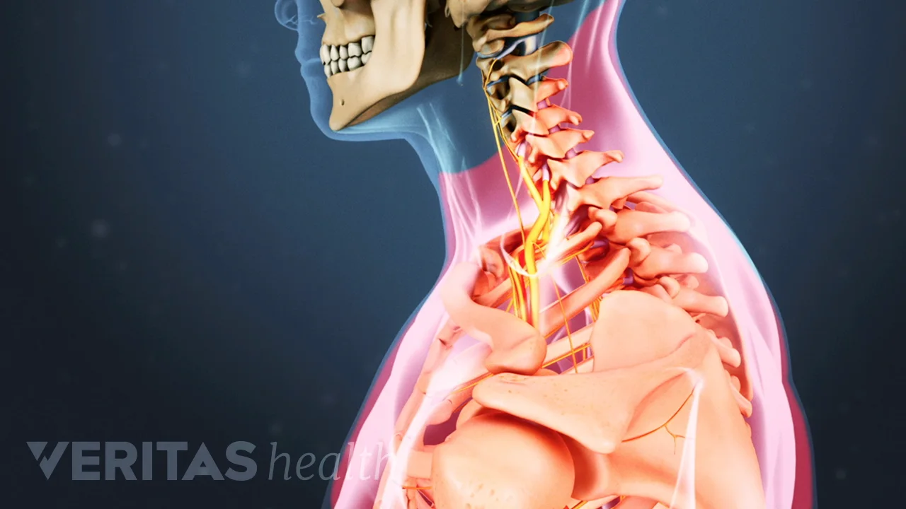 Neck Pain | Spine-health