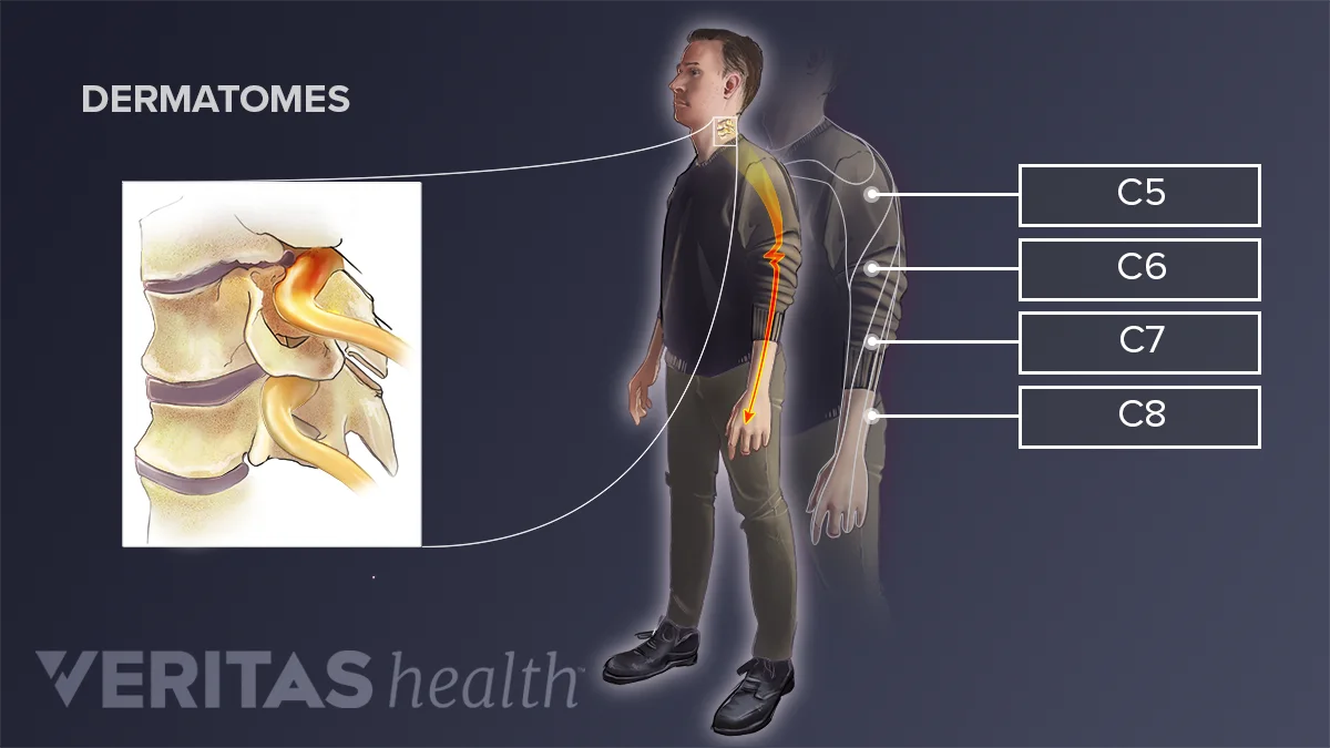 Understanding Different Types of Back Pain | Spine-health