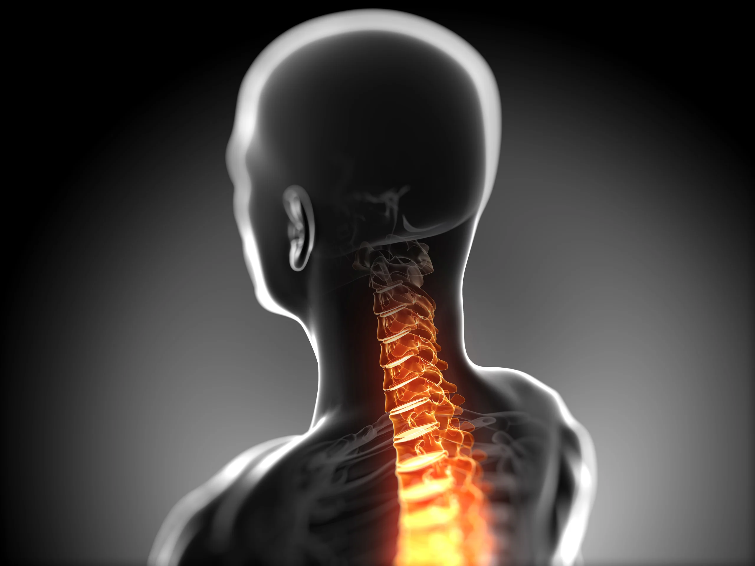 Neck Pain from Lyme Disease | Spine-health