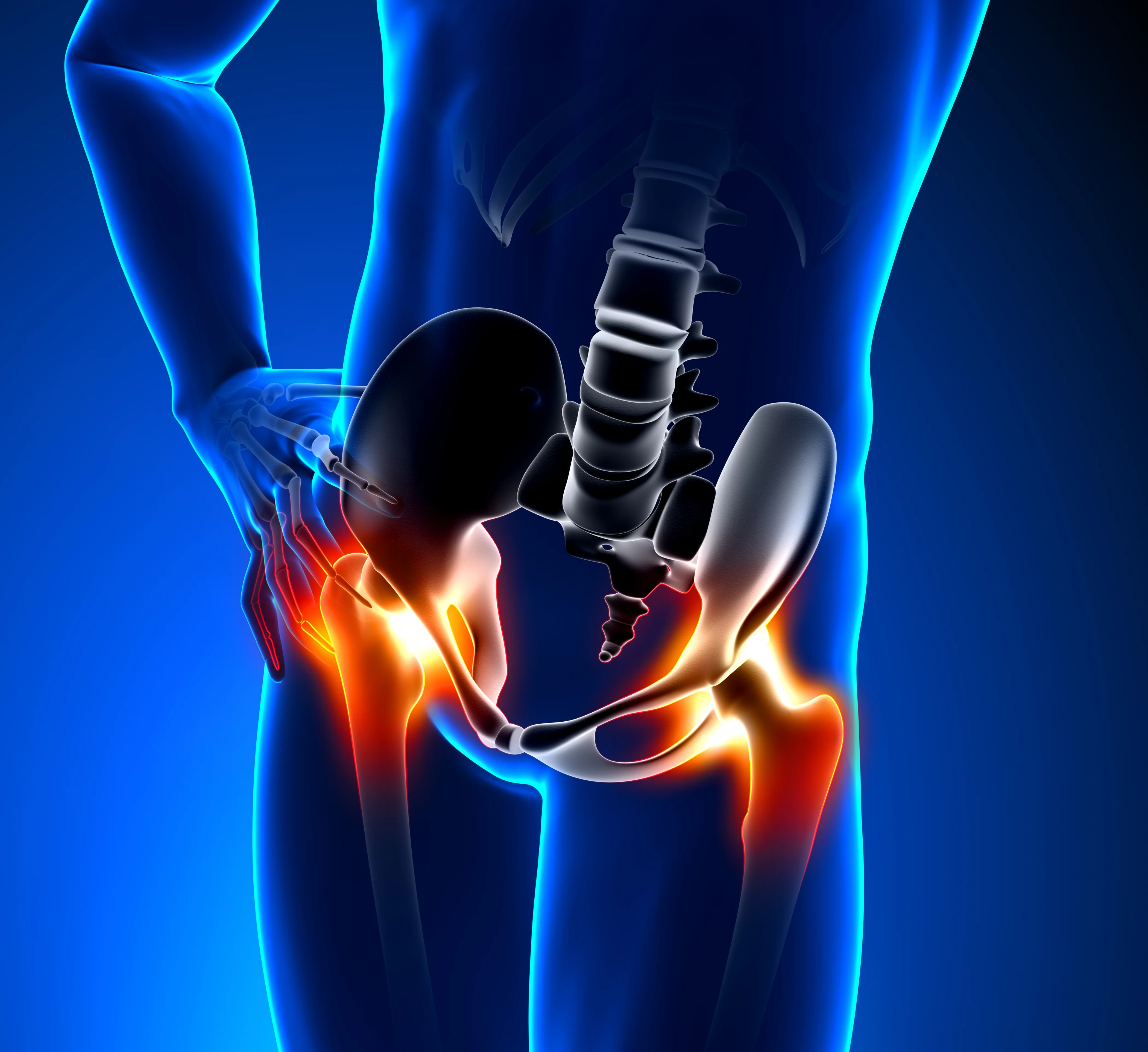 Hip Bursitis Causes | Arthritis-health