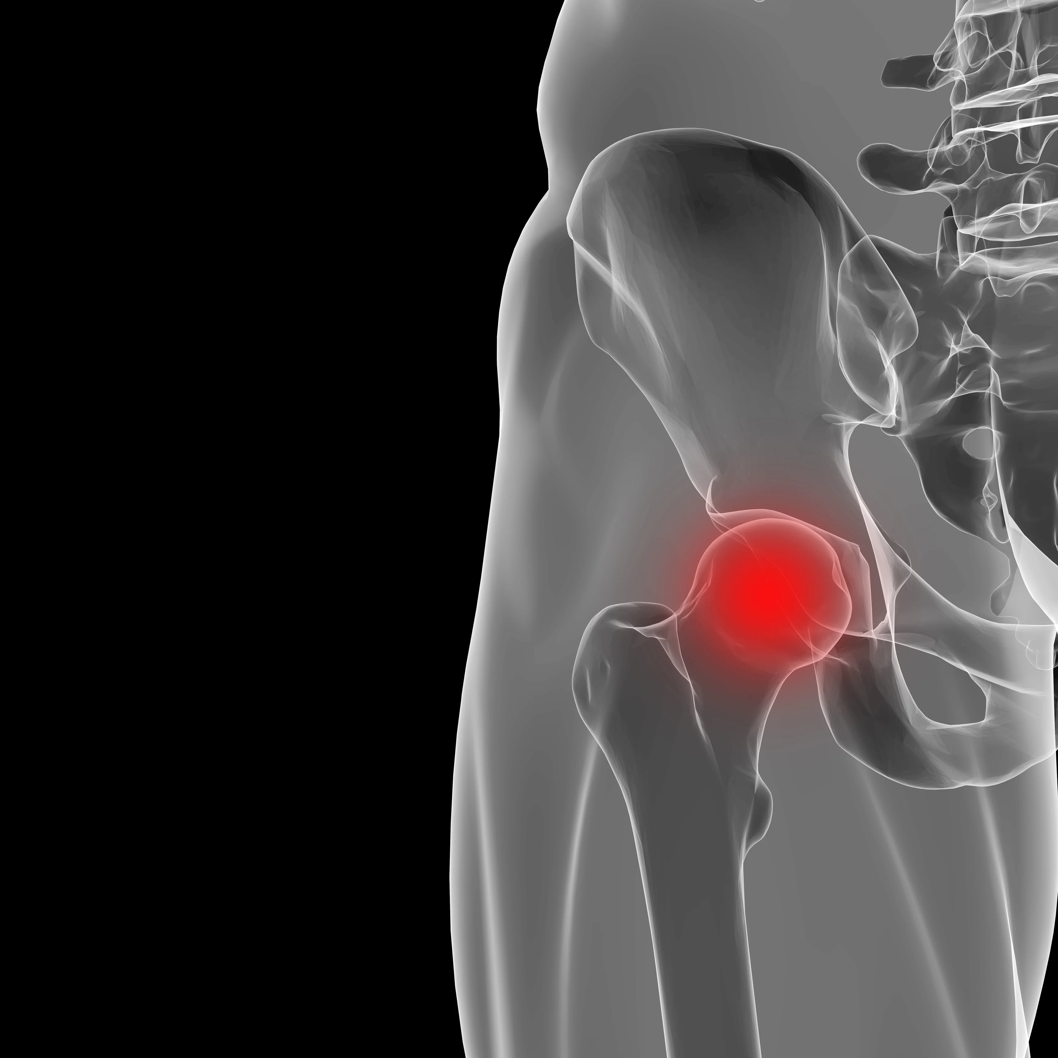Hip Bursitis Diagnosis | Arthritis-health