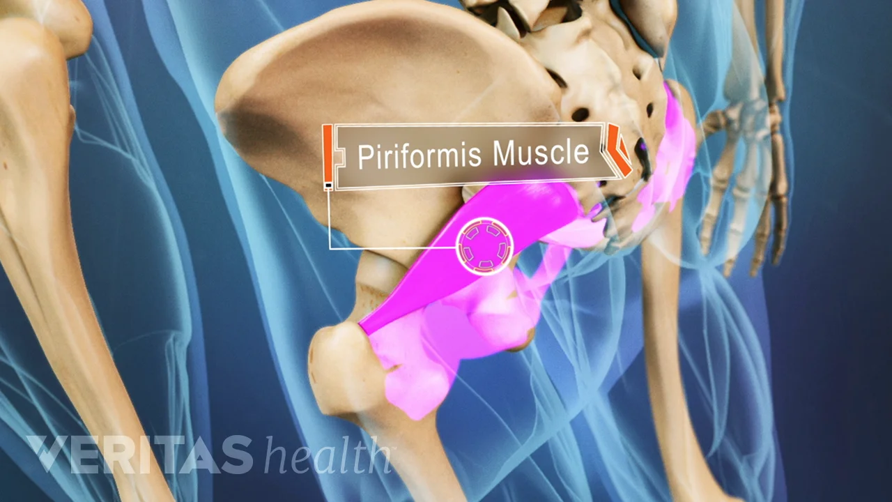 Piriformis Muscle Stretch and Physical Therapy | Spine-health