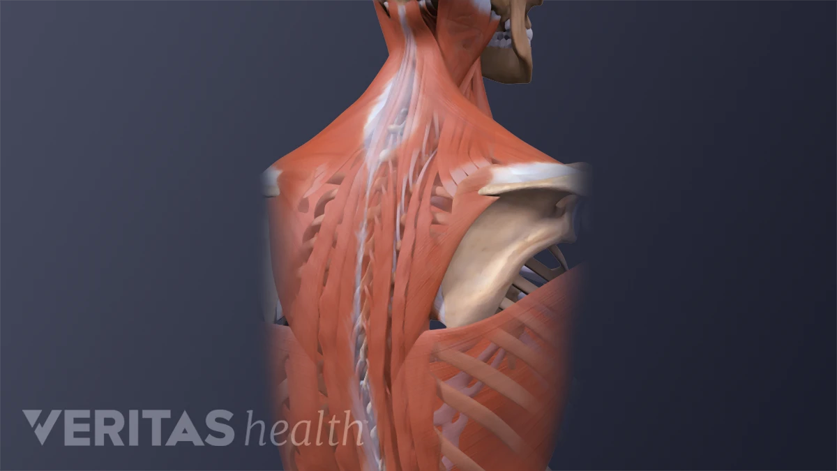 What Causes Upper Left Back Pain? | Spine-health