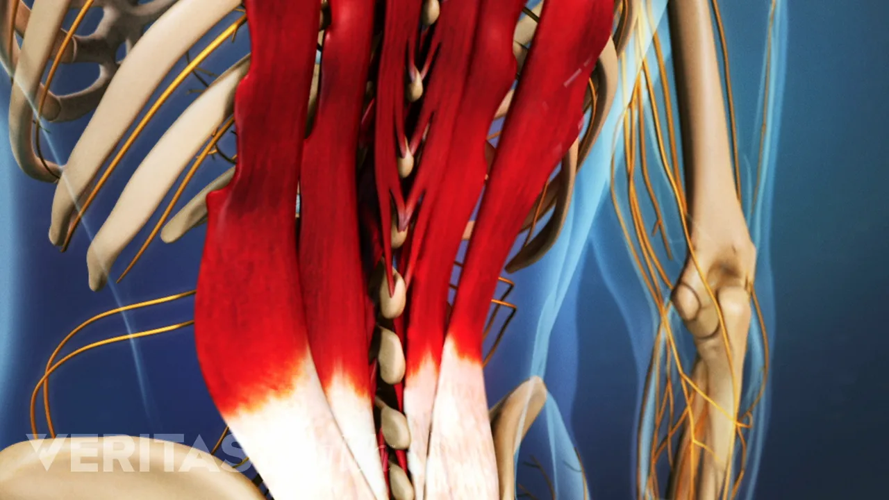 Pulled Back Muscle and Lower Back Strain | Spine-health