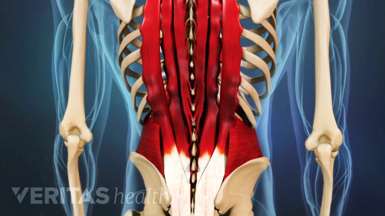 Lower Back Muscle Strain Symptoms | Spine-health