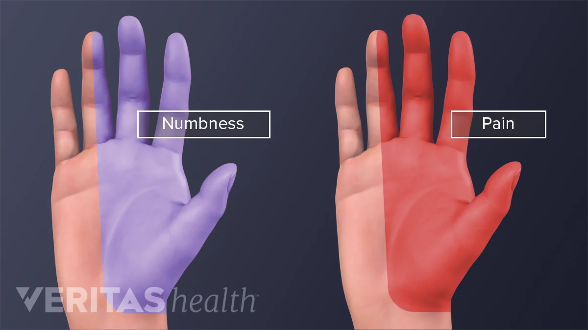 Understanding Hand Pain and Numbness | Spine-health