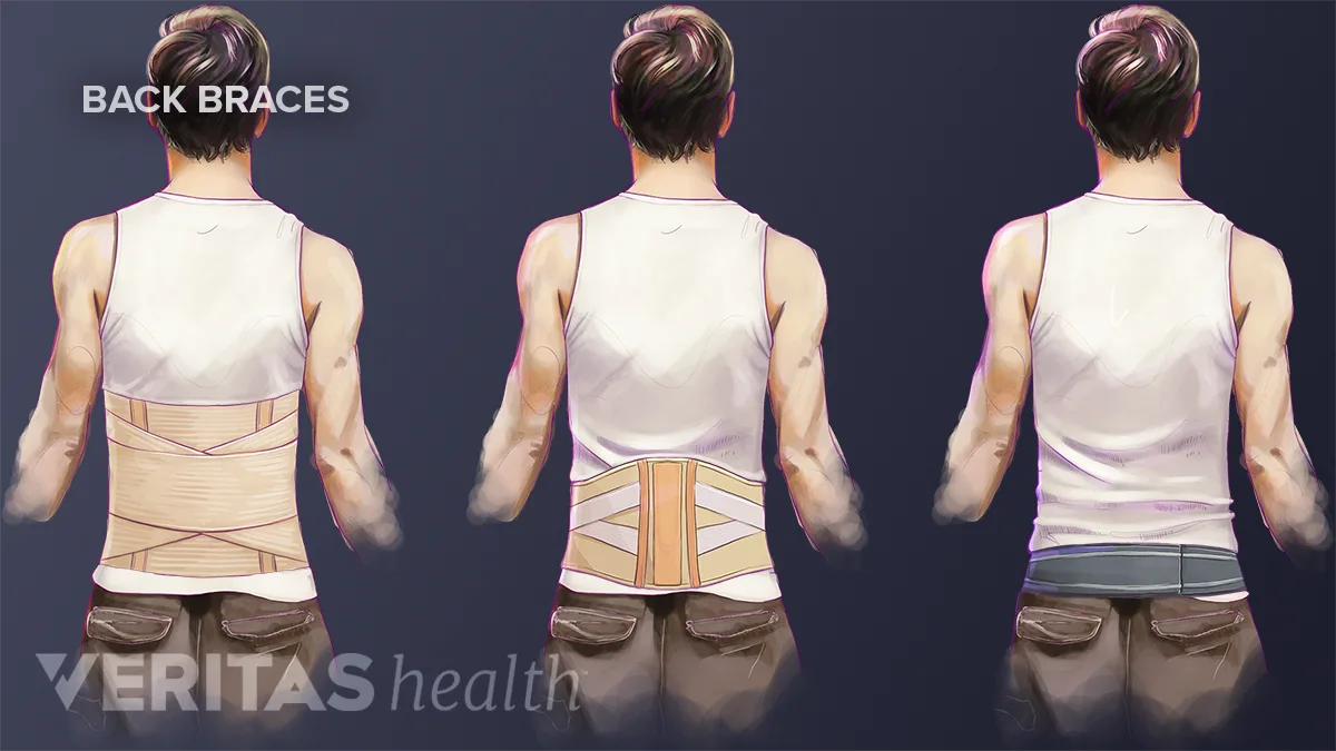 Types of Back Braces Used for Lower Back Pain Relief | Spine-health