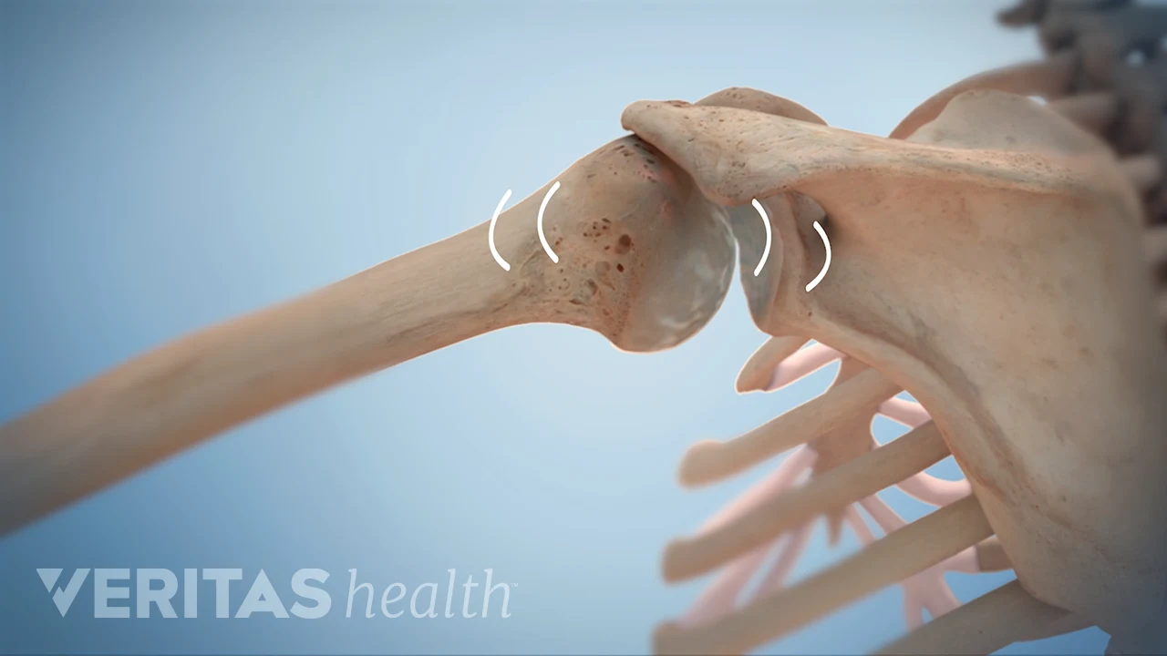 Video: Why Do My Joints Crack? | Spine-health