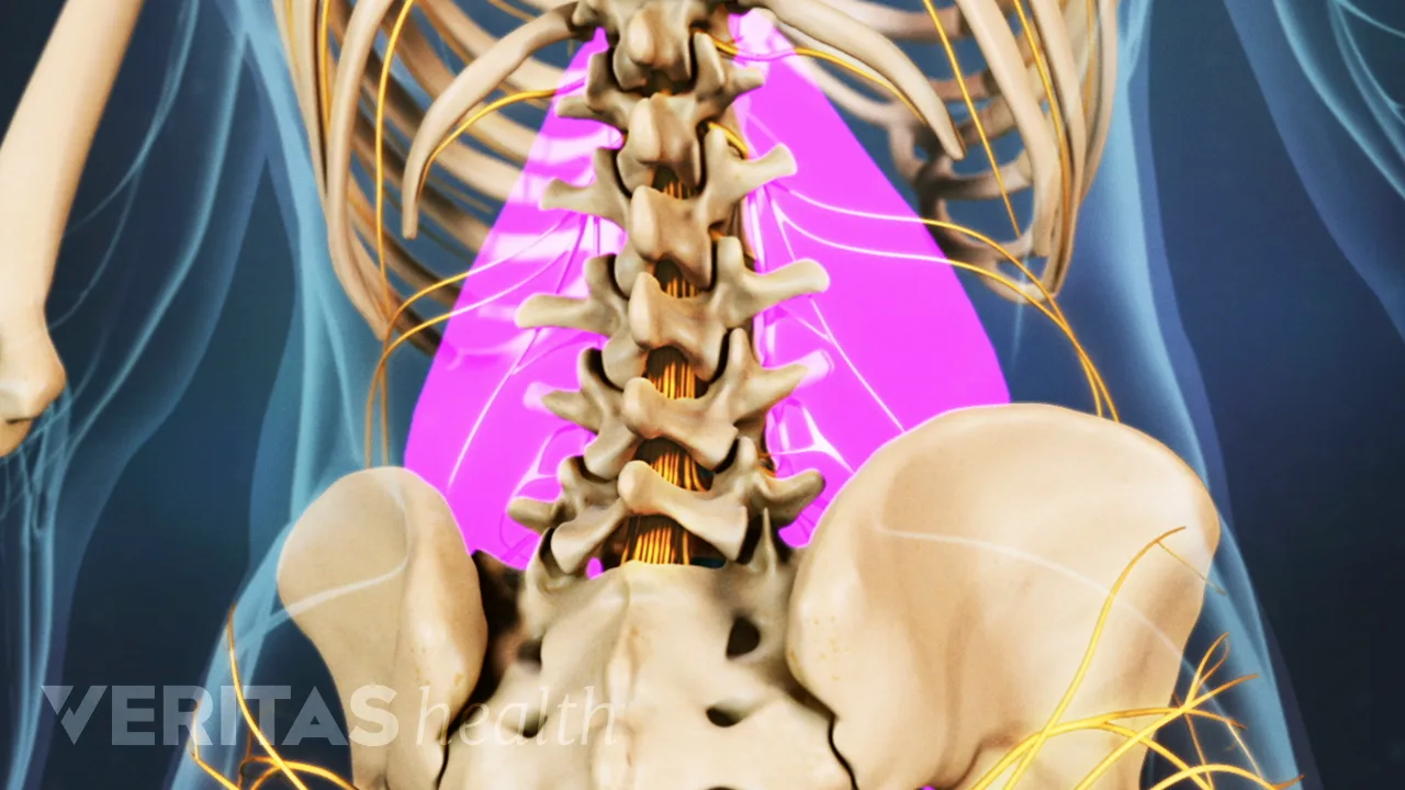 Pulled Back Muscle Treatment | Spine-health