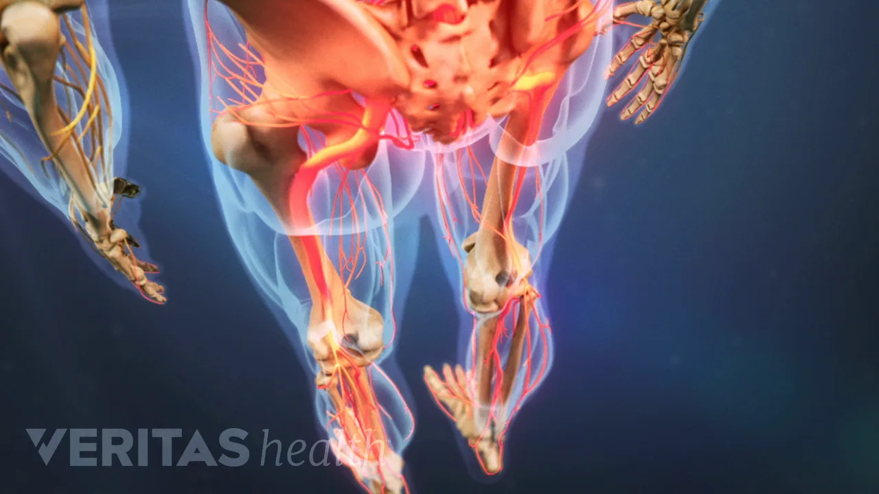 Understanding Neuropathy Symptoms | Spine-health