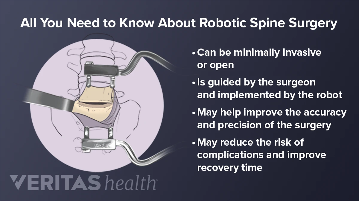 What You Need to Know About Robotic Spine Surgery | Spine-health