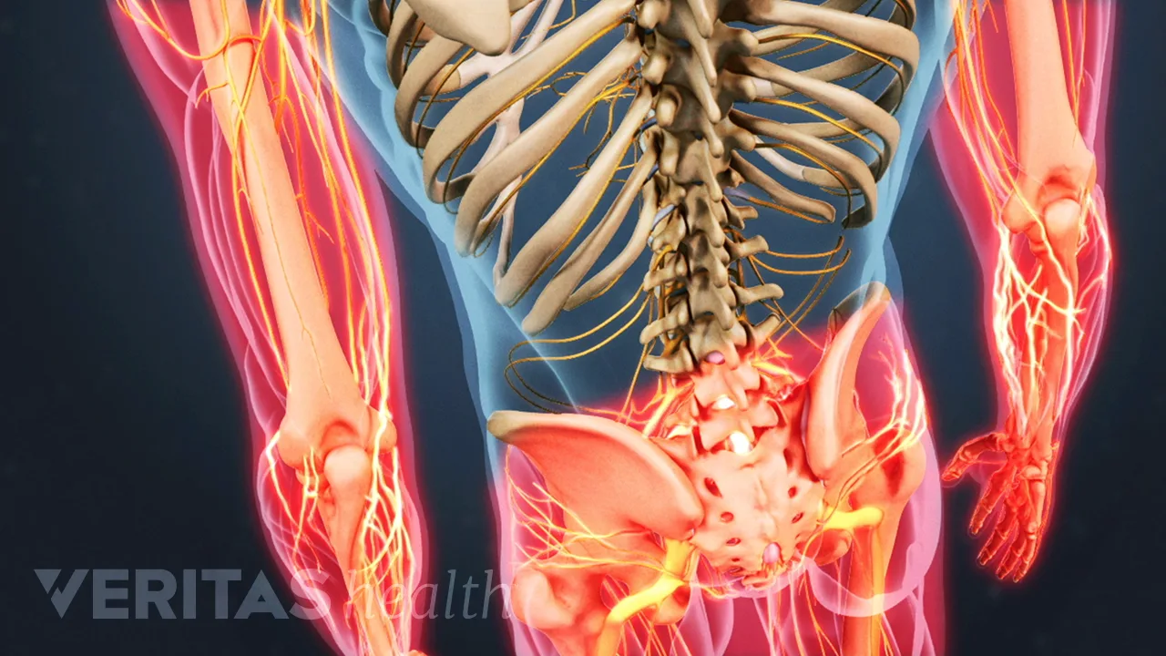 Causes of Degenerative Disc Disease Pain | Spine-health