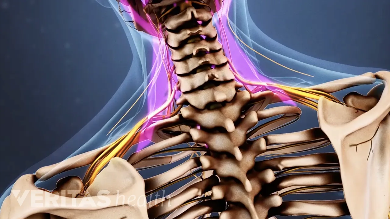 Neck Pain Symptoms | Spine-health