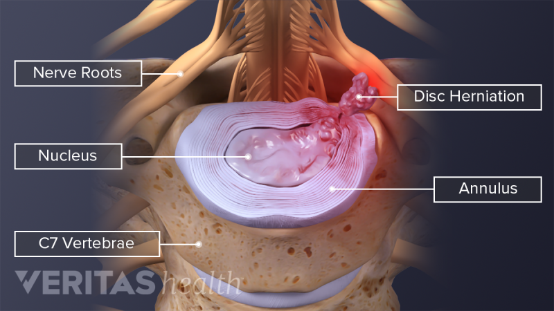Spinal Motion Segment: C6-C7 Animation | Spine-health