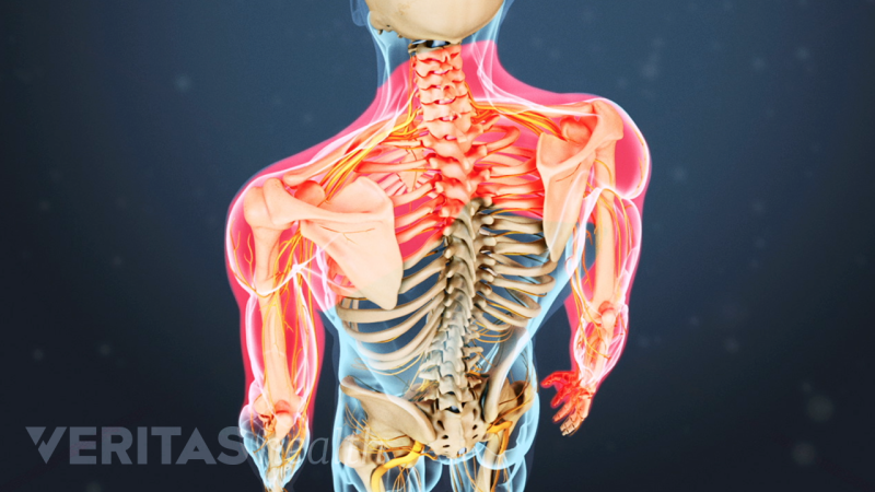 Neck Pain | Spine-health