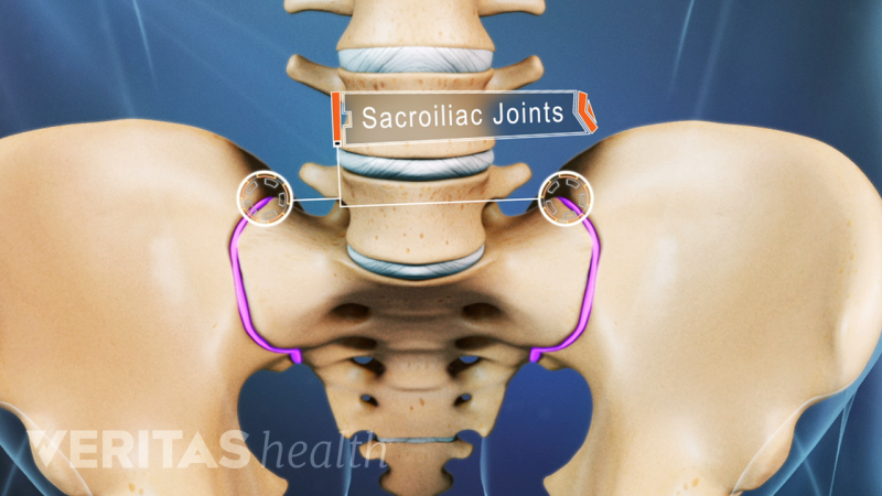 Chiropractic Adjustment Of The Sacroiliac Joint Video Spine Health