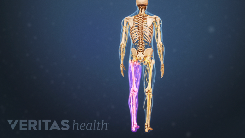 Sciatica Treatment Video | Spine-health