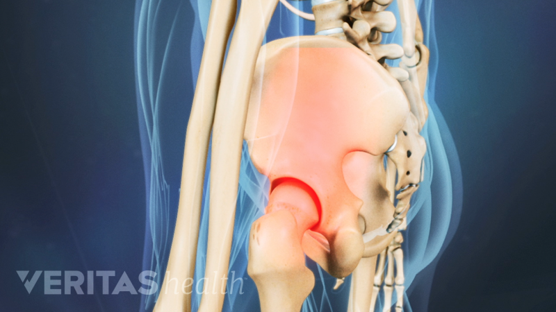 Sacroiliac Si Joint Anatomy Video Spine Health