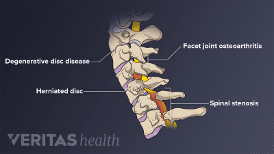 Spinal Motion Segment: C6-C7 Animation