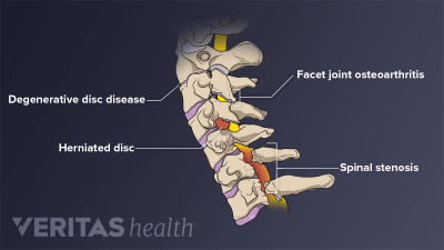 Spinal Motion Segment: C5-C6 Video | Spine-health