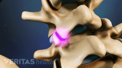 Facet Joint Anatomy Animation | Spine-health