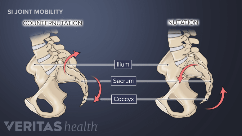 Exercise for Sacroiliac Joint Pain Relief | Spine-health