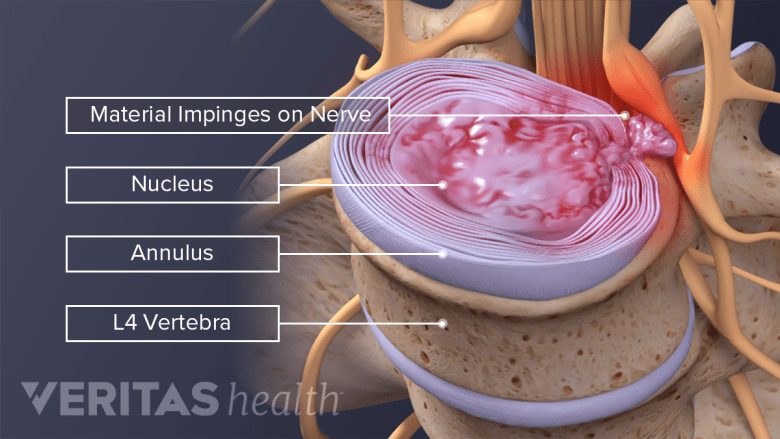 All About the L3-L4 Spinal Segment | Spine-health