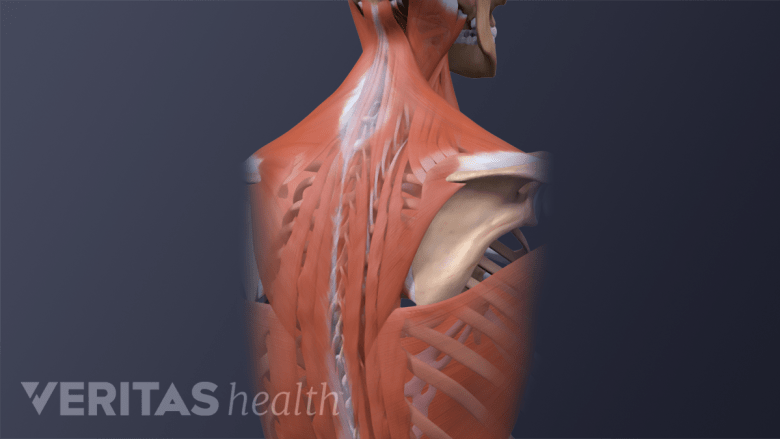 Forward Head Posture’s Effect on Neck Muscles | Spine-health