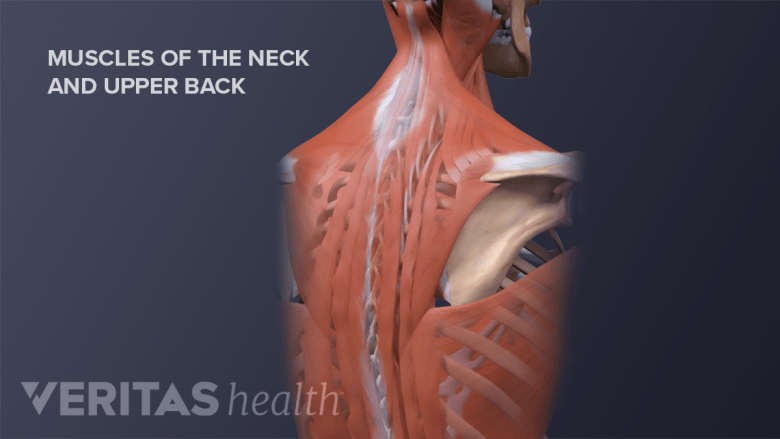 Neck Exercises for Neck Pain | Spine-health