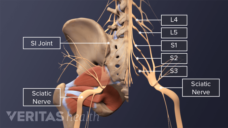 Is Sacroiliitis the Same Thing as Sciatica? | Spine-health