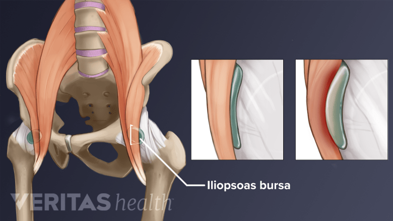 Causes of Leg Pain and Foot Pain | Spine-health