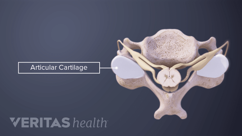 How Cervical Facet Joint Degeneration Occurs | Spine-health
