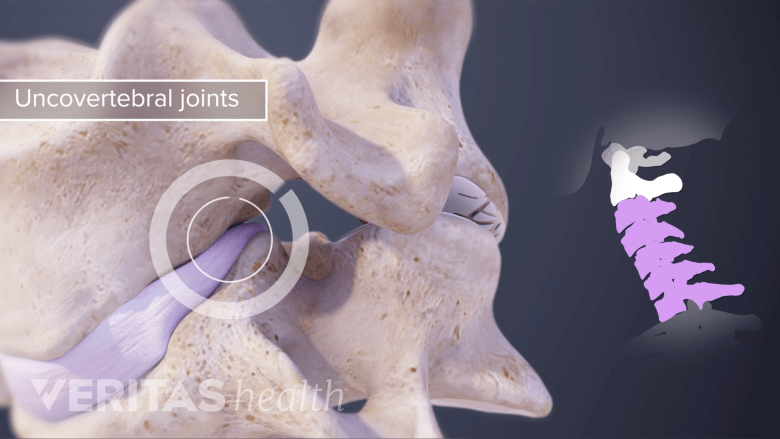 How Cervical Facet Joint Degeneration Occurs | Spine-health