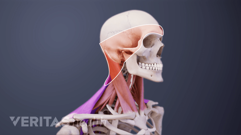 Neck Pain and Tension Headache | Spine-health