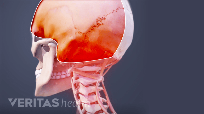Neck Pain and Migraine Headache | Spine-health