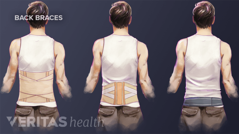 Types of Back Braces Used for Lower Back Pain Relief | Spine-health