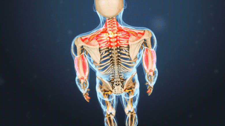 Neck Strain Symptoms | Spine-health