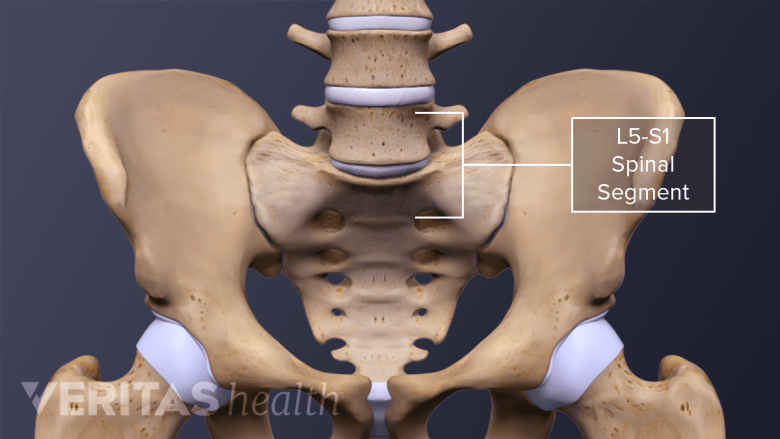 All about L5-S1 (Lumbosacral Joint) | Spine-health